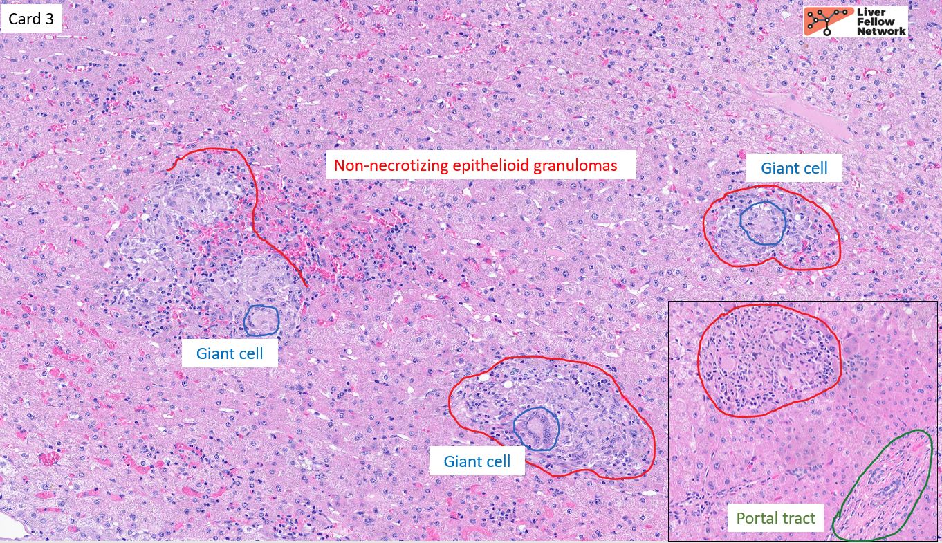 Liver Pathology | AASLD